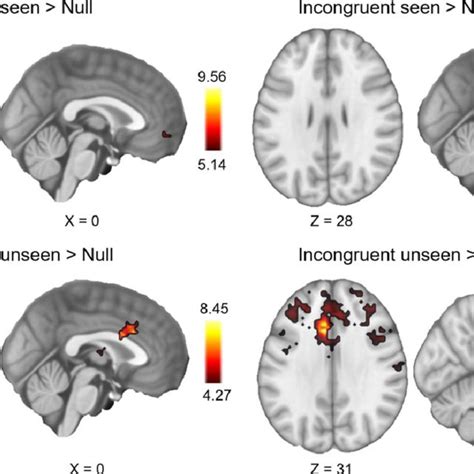 Brain Regions Showing Whole Brain Functional Connectivity Using The