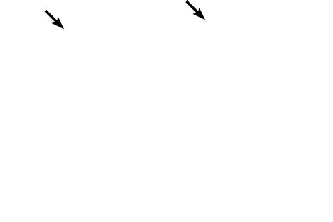 Heart 9a Digital Histology
