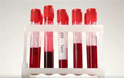 How Often Should I Get Tested For Stds Important Considerations Centers Urgent Care