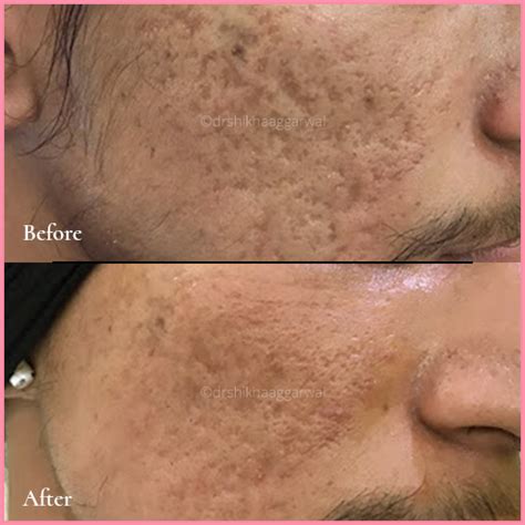 Real Results Dr Shikha Aggarwal