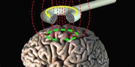 El Cerebro Adicto C Mo Las Drogas Anulan Las Capacidades Humanas Infobae