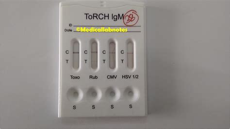 TORCH Panel Introduction Group Of Test Test Device Clinical