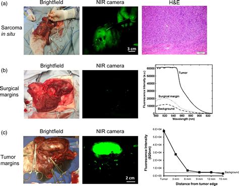 Intraoperative Near Infrared Fluorescence Imaging And Spectroscopy Identifies Residual Tumor