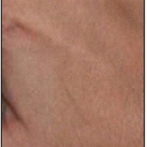 Skin Color Clustering Download Scientific Diagram