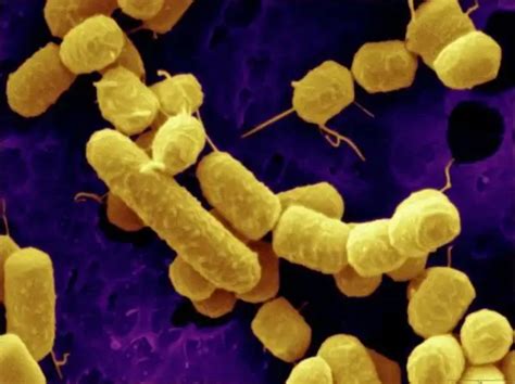 Lactobacillus Plantarum Novomicrobiom