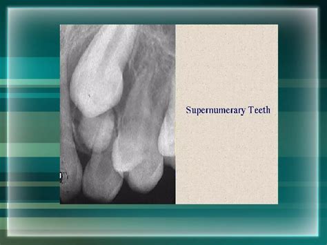 Hard Tissue Charting Ppt