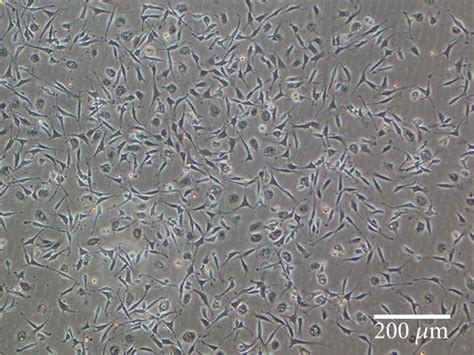 Culture And Characterization Of Rat Bone Marrow Derived Epcs A Download Scientific Diagram