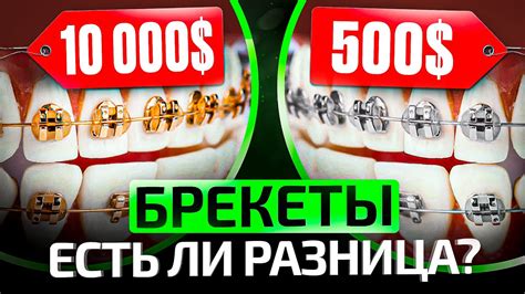 Самые дешевые и самые дорогие БРЕКЕТЫ — есть ли смысл переплачивать ...