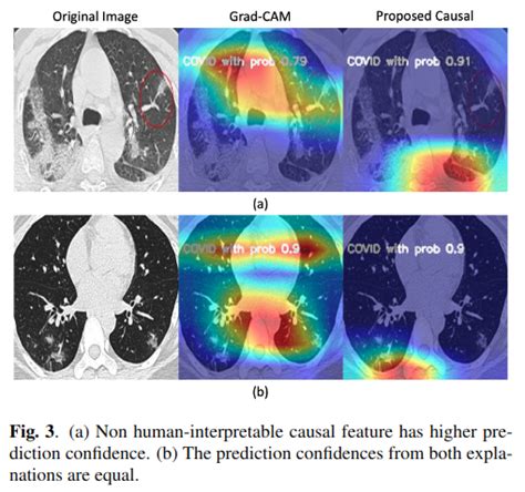 Contrastive Explanations In Neural Networks — Olives