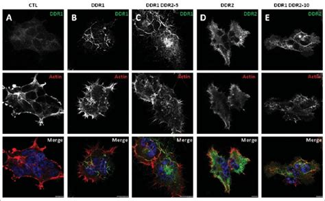 Immunocytofluorescence Localization Of DDR1 DDR2 And Filamentous Actin Download Scientific
