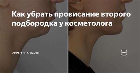 Как убрать провисание второго подбородка у косметолога | Хирургия ...