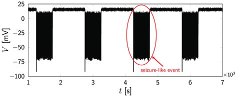 Seizure Like Events With The Memristive Neuromorphic Circuit Download Scientific Diagram