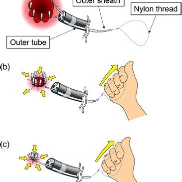 The Actual Usage A The Loop Was Placed Around The Defect And Fixed Download Scientific