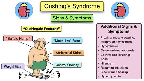 Cushing Syndrome Causes