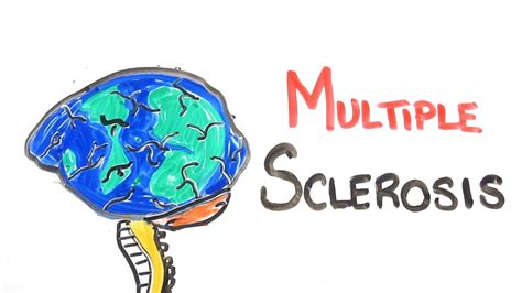 What Is Multiple Sclerosis Simple Education