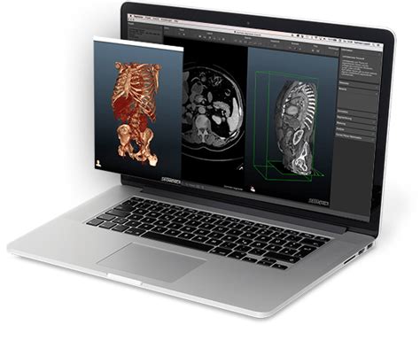 do you know a free dicom viewer that allows for freely rotatable 3d mpr