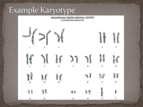 Ppt Complex Inheritance Patterns Powerpoint Presentation Free