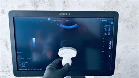 Refurbished Ge Logiq E10 For Sale 45 773 Usd Item 2044019 Bimedis