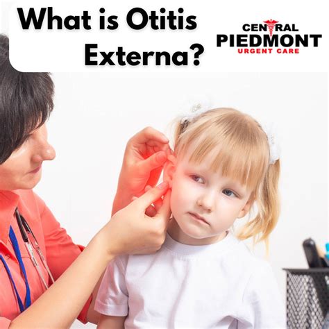 Central Ever Heard Of Otitis Externa Its A Common Ear Infection