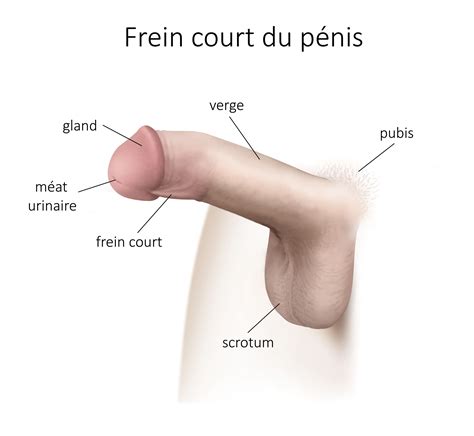 Understanding Frenulum Tear Dr Carlos Marois Private Urologist