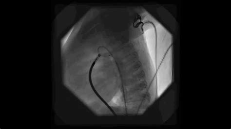 Pda Device Closure Guidelines At Evelyn Shank Blog