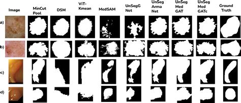 UnSegMedGAT: Unsupervised Medical Image Segmentation using Graph Attention Networks Clustering