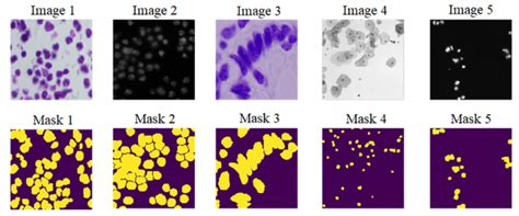 Review — Inception U Net Architecture For Semantic Segmentation To