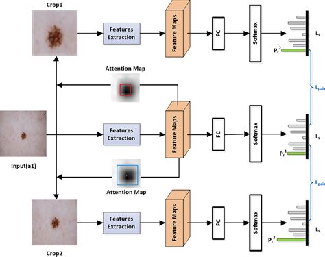 Figure 1 From Multiscale Ensemble Of Convolutional Neural Networks For Skin Lesion
