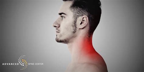 Cervical Fusion Surgery Mckinney Tx Advanced Spine Center