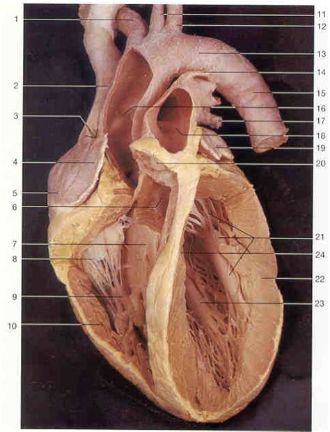 Cadaver Heart