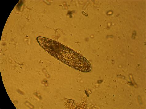 Help Does Anyone Know What Kind Of Eggs Are These