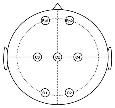 Eog Artifact Correction From Eeg Recording Using Stationary Subspace Analysis And Empirical Mode