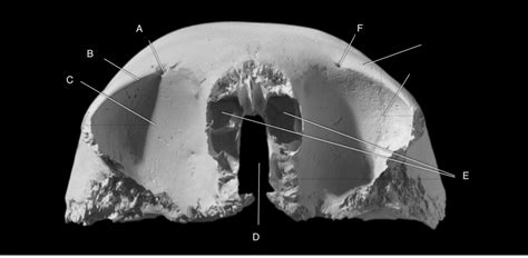 Diagram Of Frontal Inferior Ectocranial Quizlet