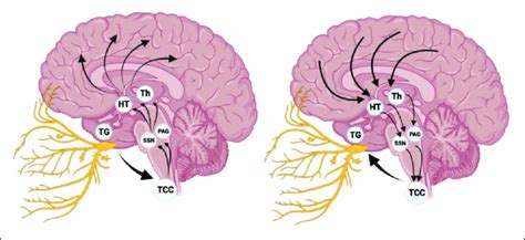 Simplified Graphical View Of The Trigeminovascular System In Secondary