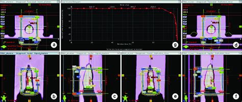 The Isodose Lines Difference Of The Treatment Plan In A Axial B