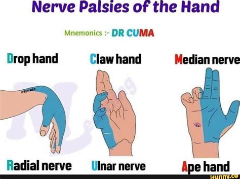 Nerve Palsies Of The Hand Mnemonics Dr Cuma Drop Hand Claw Hand Median