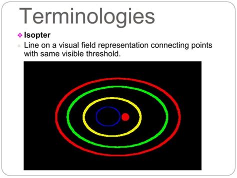 Automated Perimetry Ppt Automated Perimetry Ppt