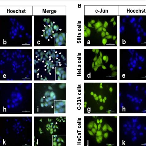 Nuclear Translocation Of C Fos And C Jun Proteins In Cervical Cancer Download Scientific