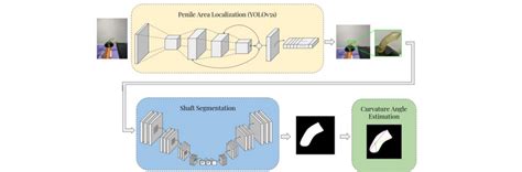Automated Quantification Of The Degree Of Penile Curvature Using Artificial Intelligence Sidra