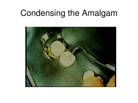 Ppt Amalgam Restoration Powerpoint Presentation Free Download Id 4311712