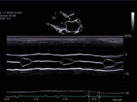 Echo Quiz Flashcards Quizlet