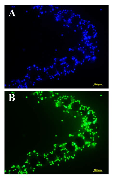 Video Clinical Microfluidic Chip Platform For The Isolation Of Versatile Circulating Tumor Cells