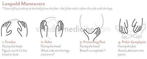 Pin By Matt Kaiser On Usmle Step Leopolds Maneuver Pediatric Nursing Pharmacology Nursing