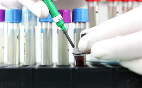 Top 7 Trends In Qpcr Reagents Verified Market Reports