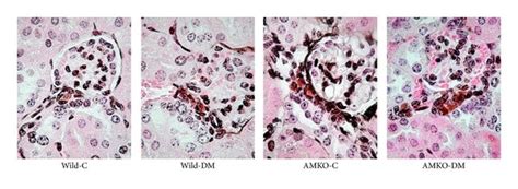 Renin Secreting Granular Cells In The Juxtaglomerular Apparatus And