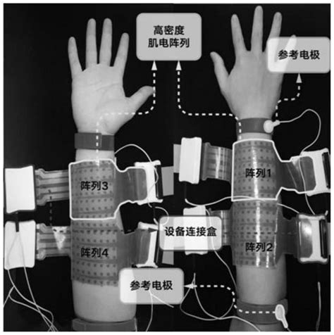 Unsupervised Calibration Method For Myoelectric Artificial Limb Control Eureka Patsnap