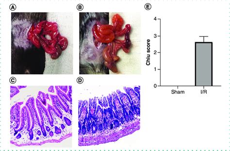 Intestinal Ischemia Histology At Alannah Wrigley Blog
