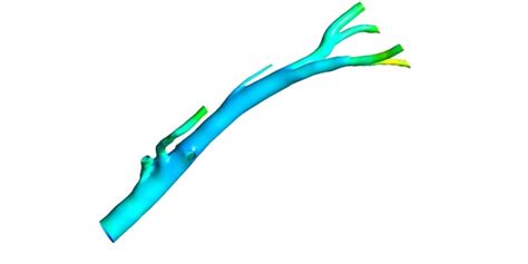 Human Aorta Simulation Fetchcfd