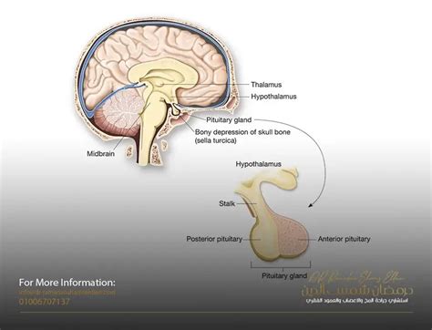 Transsphenoidal Surgery Post Operative Instructions