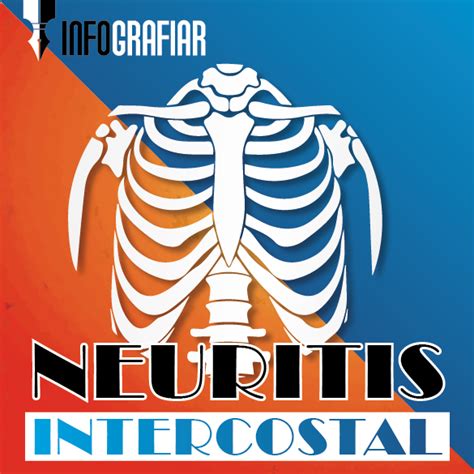 Neuritis Intercostal